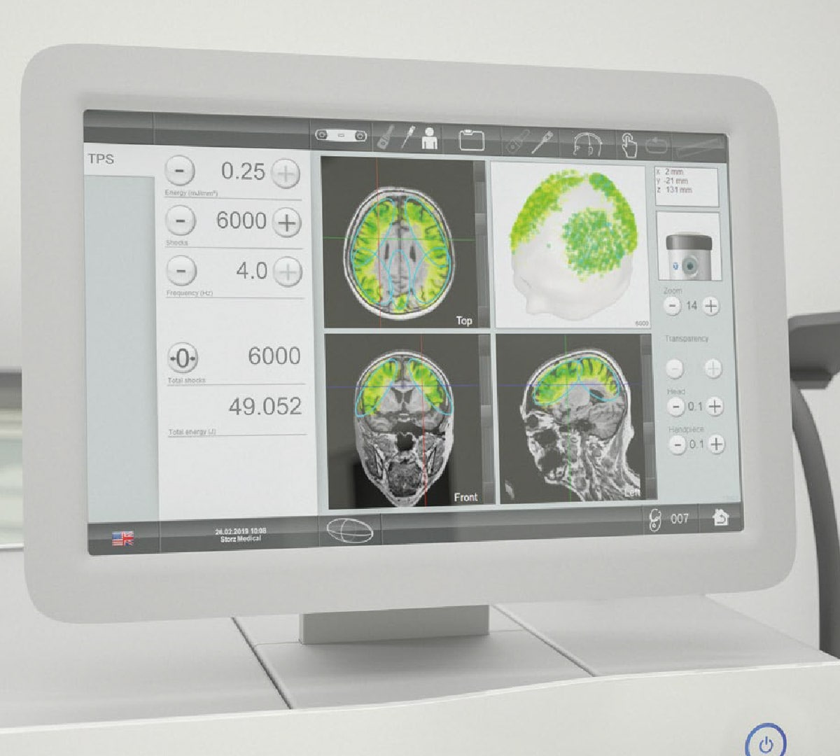 NEUROLITH® – Robotimize