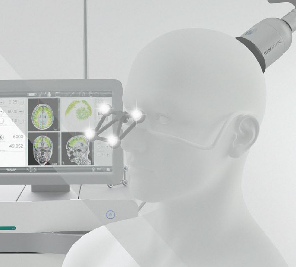 NEUROLITH® – Robotimize