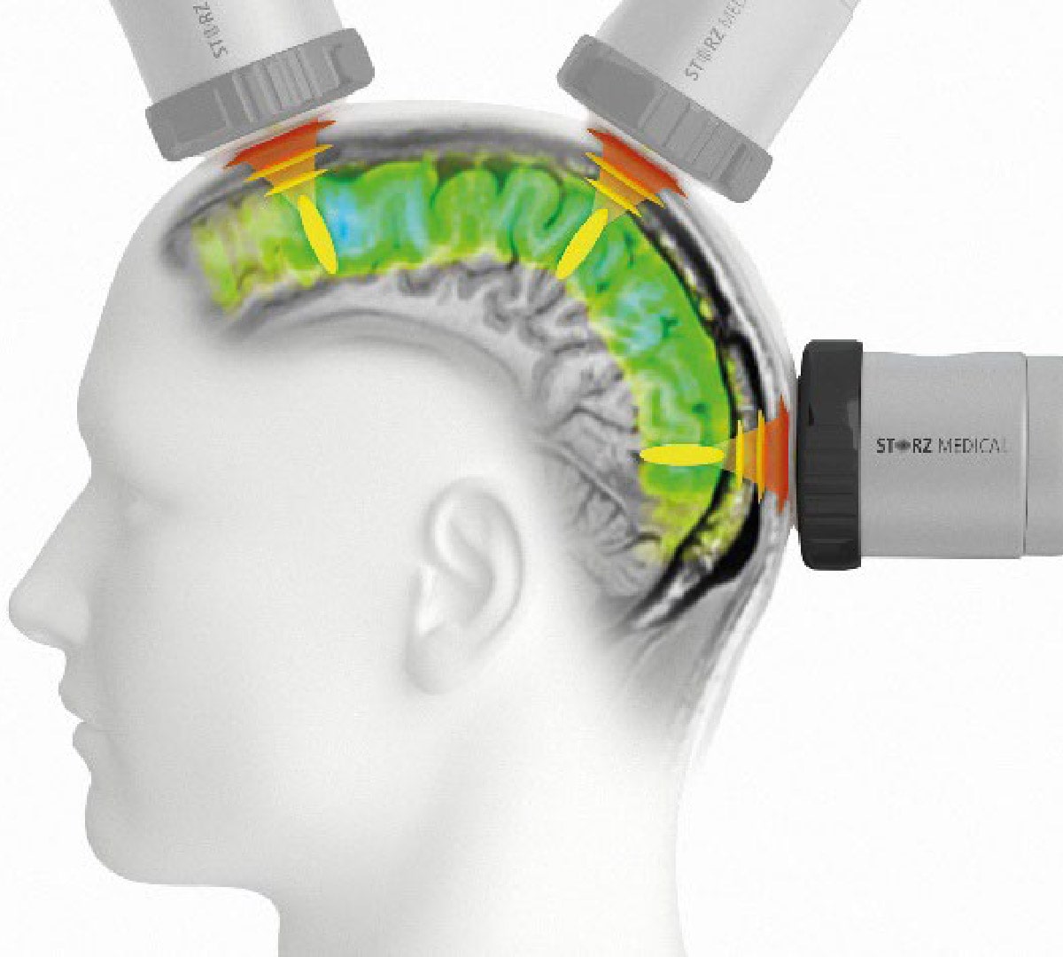 NEUROLITH® – Robotimize